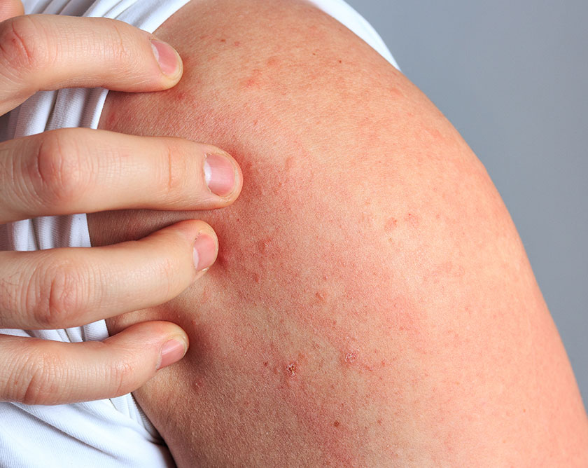 D – Dra. Priscilla Ortiz